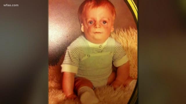 'Wonder' movie empowers families dealing with Treacher Collins Syndrome ...